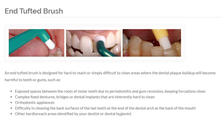 How Cleaning Between Your Teeth Can Change Your Life & Other Dental ...