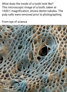 Sensitive Teeth: Causes and Options You Need to Know About - Britten Perio