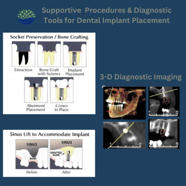 Lack of Posterior (Back Teeth) and Splaying of the Front Teeth ...